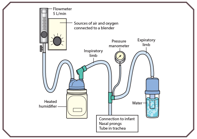 Continuous Positive Airway Pressure Obgyn Key