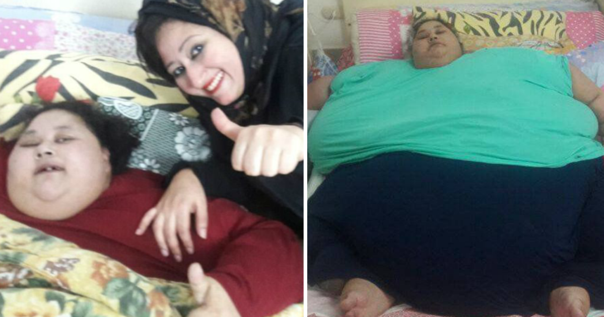 Worlds Fattest Woman Lost 5st In A Week Before Lifesaving Operation
