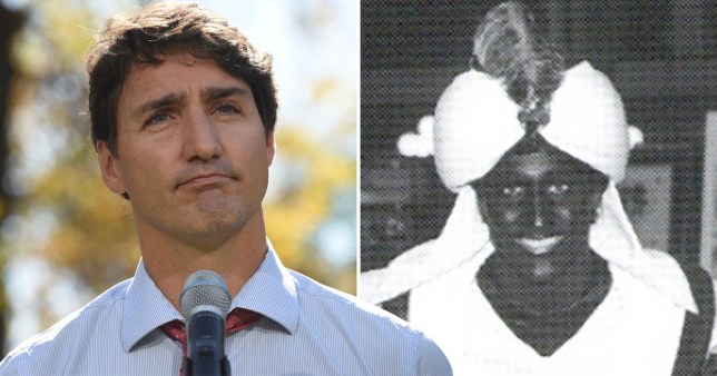 Justin Trudeau Cannot Remember How Many Times He Wore Blackface Metro