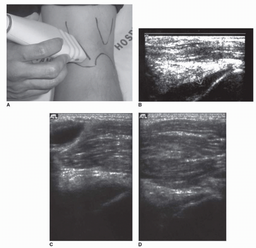 Diagnostic Ultrasound Musculoskeletal Key