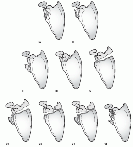 Pediatric Shoulder Musculoskeletal Key