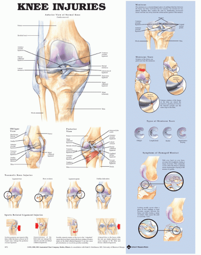 Athlete With Acute Knee Injuries Musculoskeletal Key