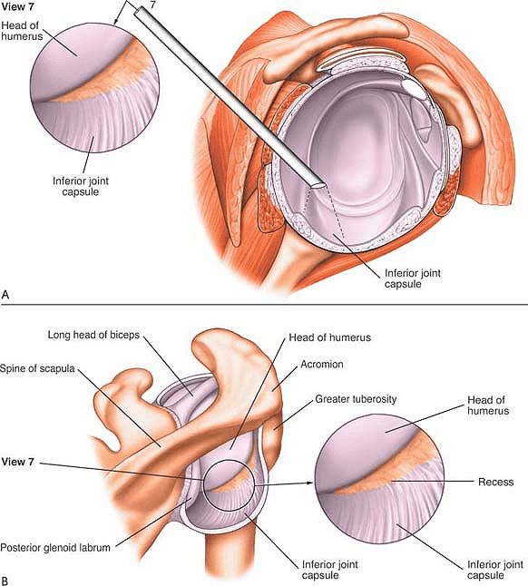 The Shoulder Musculoskeletal Key