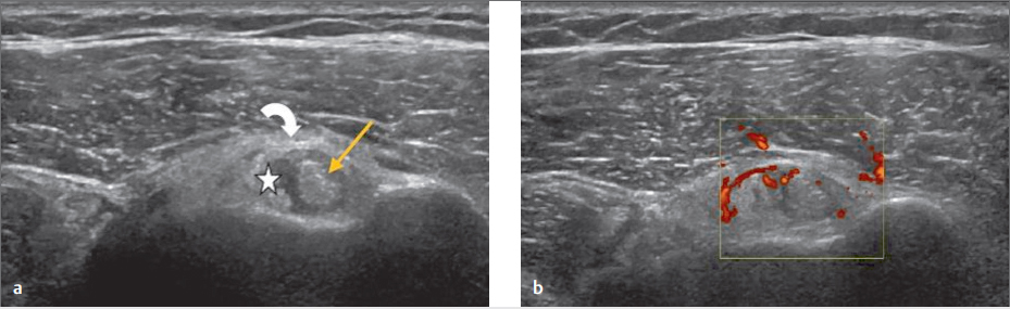 2 The Shoulder Diagnostic Imaging Musculoskeletal Key