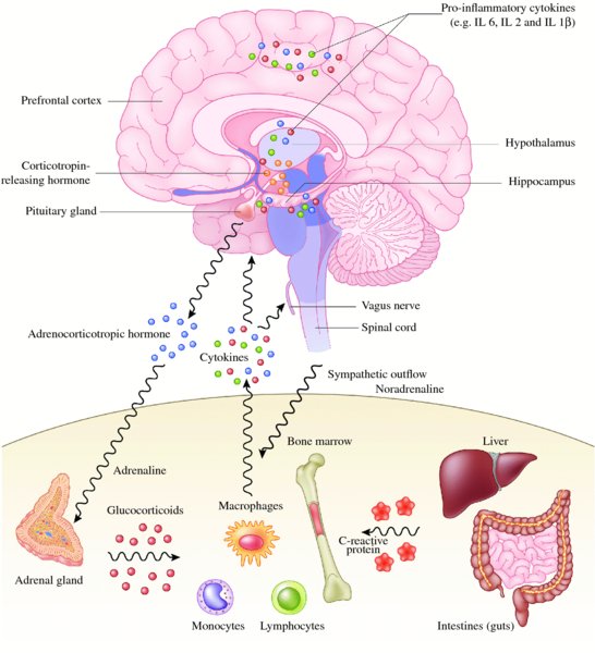 Demyelinating Disorders Of The Cns Neupsy Key