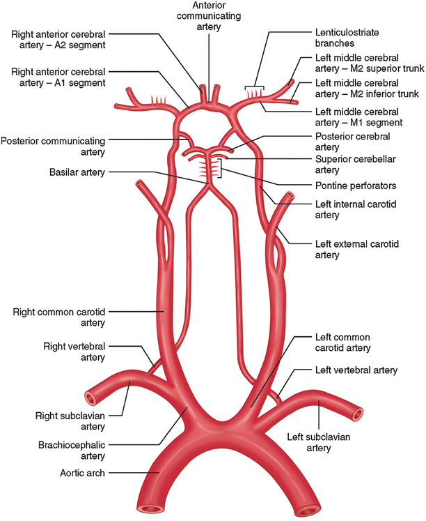 Cerebral Arterial Anatomy