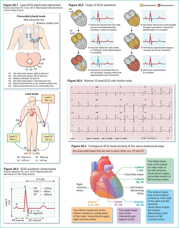 The 12 Lead Electrocardiogram Nurse Key