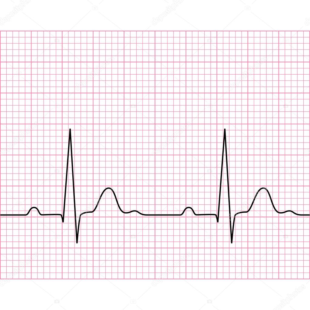 Qual A Diferença Entre Ecocardiograma E Eletro Electriades