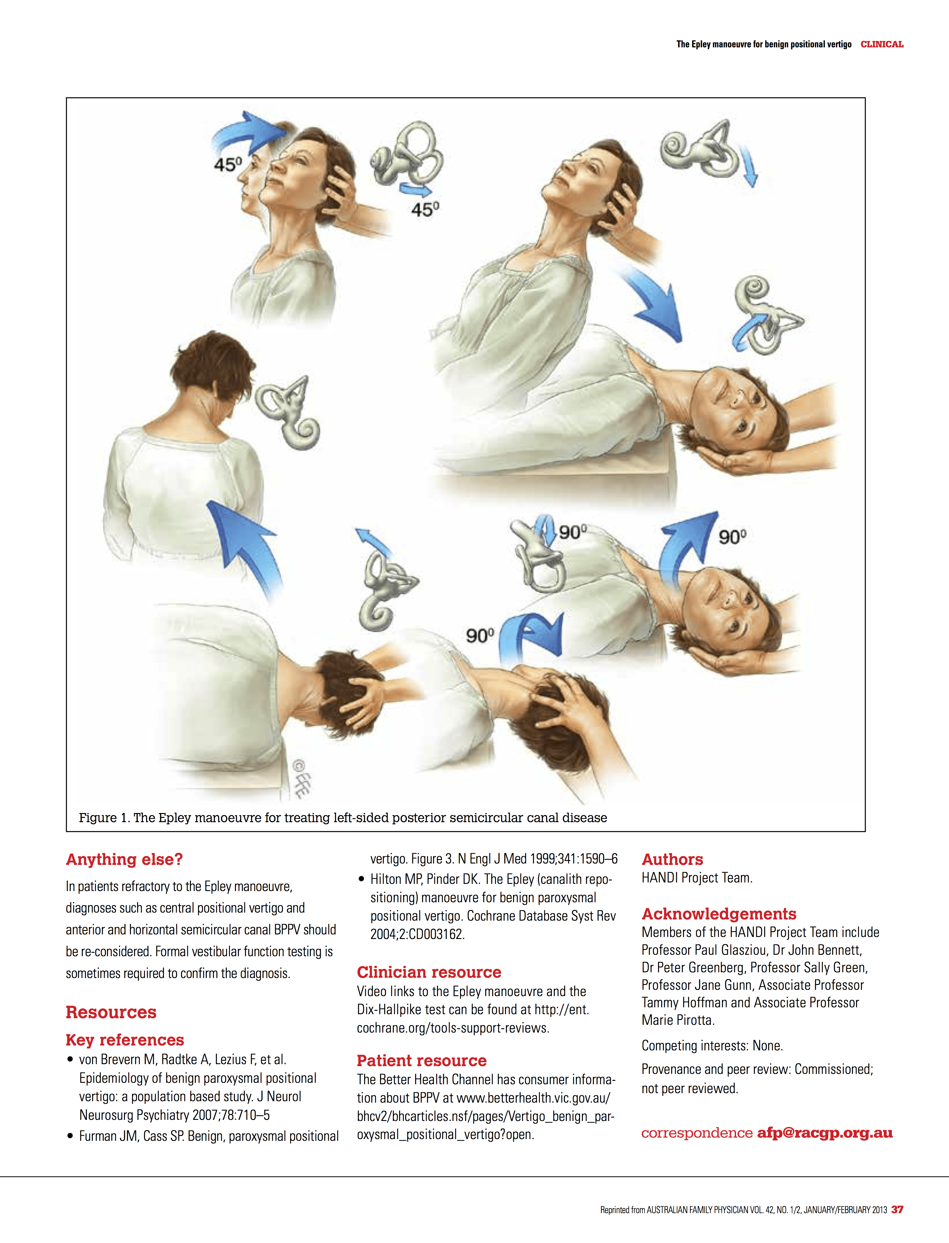 Epley Maneuver Epley Maneuver Physical Therapy Physical Therapist