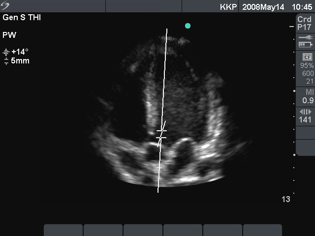 Echo Pocket Icu