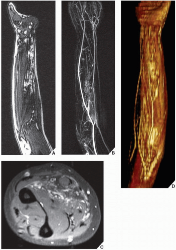 Imaging Techniques In Orthopedics Radiology Key