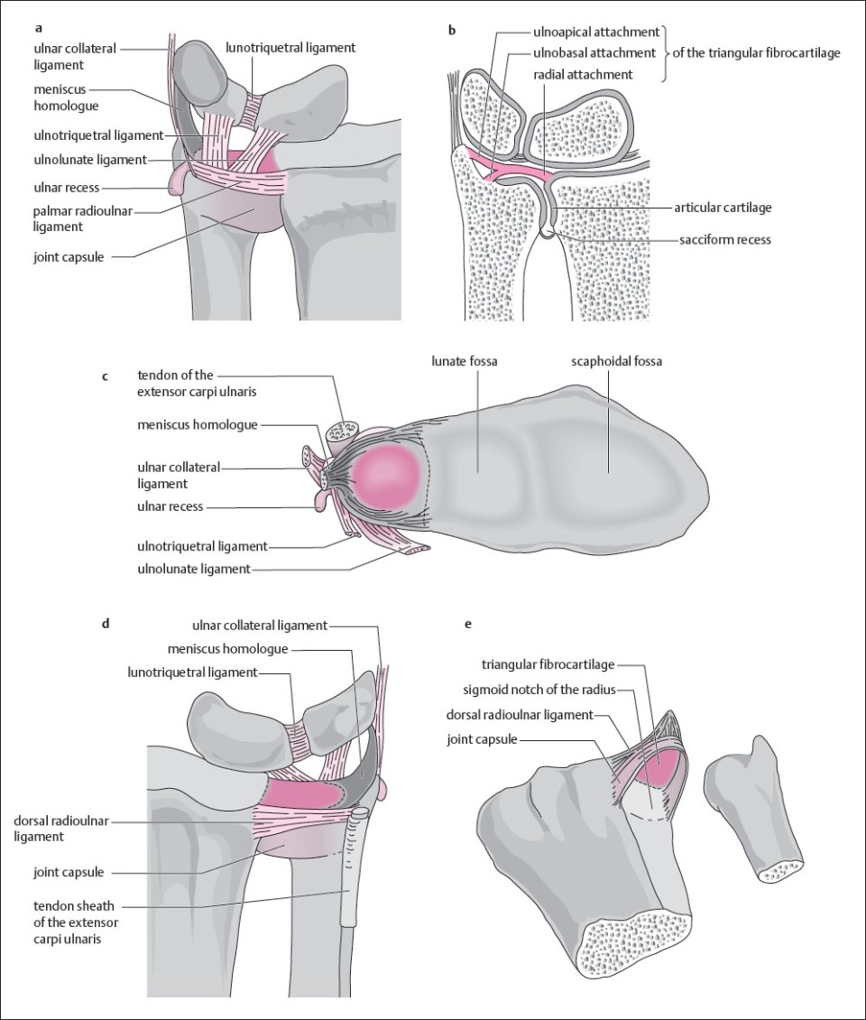 11 Triangular Fibrocartilage Complex Radiology Key