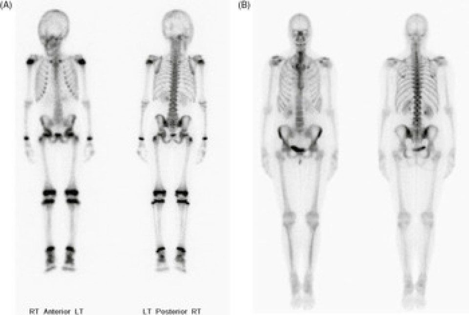 9 Nuclear Medicine Imaging Radiology Key