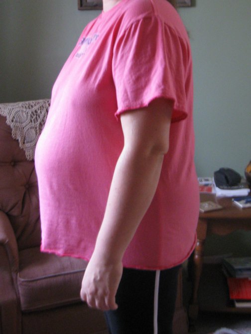 Diastasis Recti From A Moms Perspective