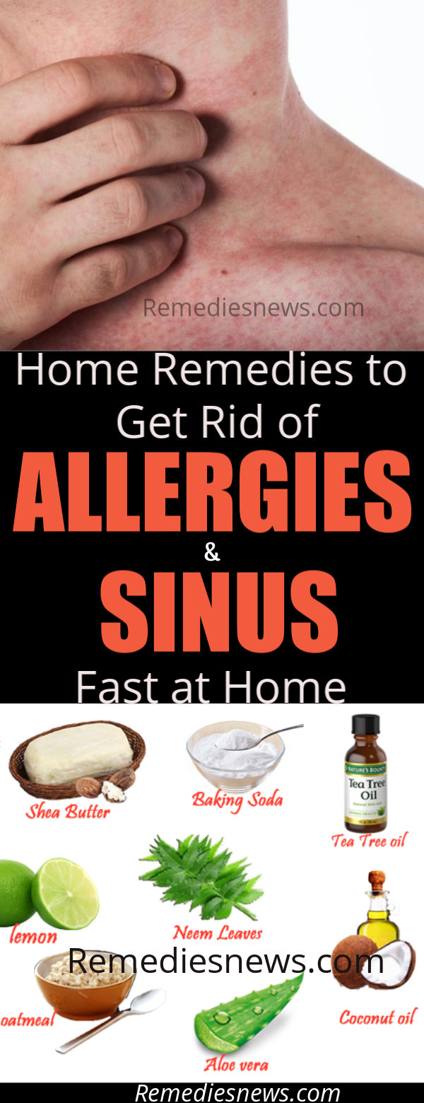 12 Home Remedies To Get Rid Of Allergies And Sinus Fast Remediesnews