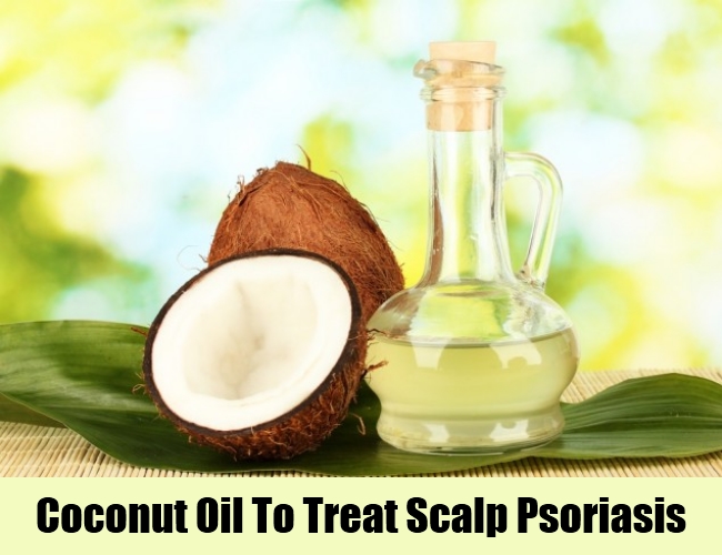 5 Remedies For Scalp Psoriasis Natural Home Remedies And Supplements