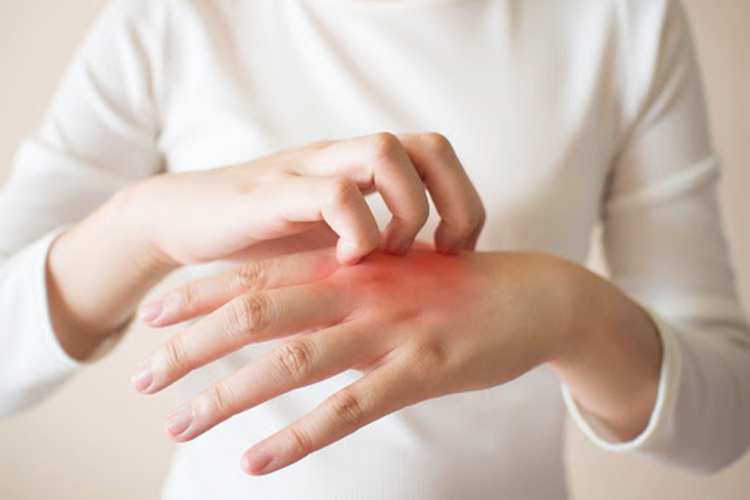 What Is Pruritus Itchy Skin Symptoms Causes And Recommendations