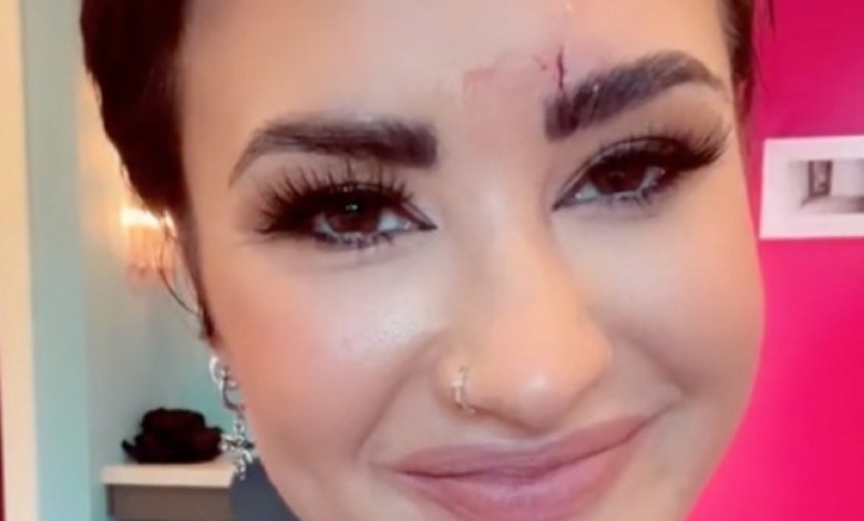 Demi Lovato Suffers A Bloody Facial Injury After Banging Her Head On