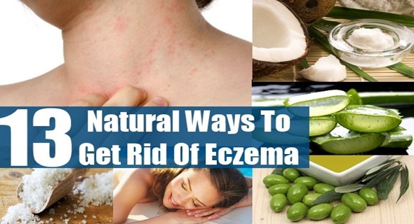 13 Home Remedies To Get Rid Of Eczema Naturally Healthy Food Advice
