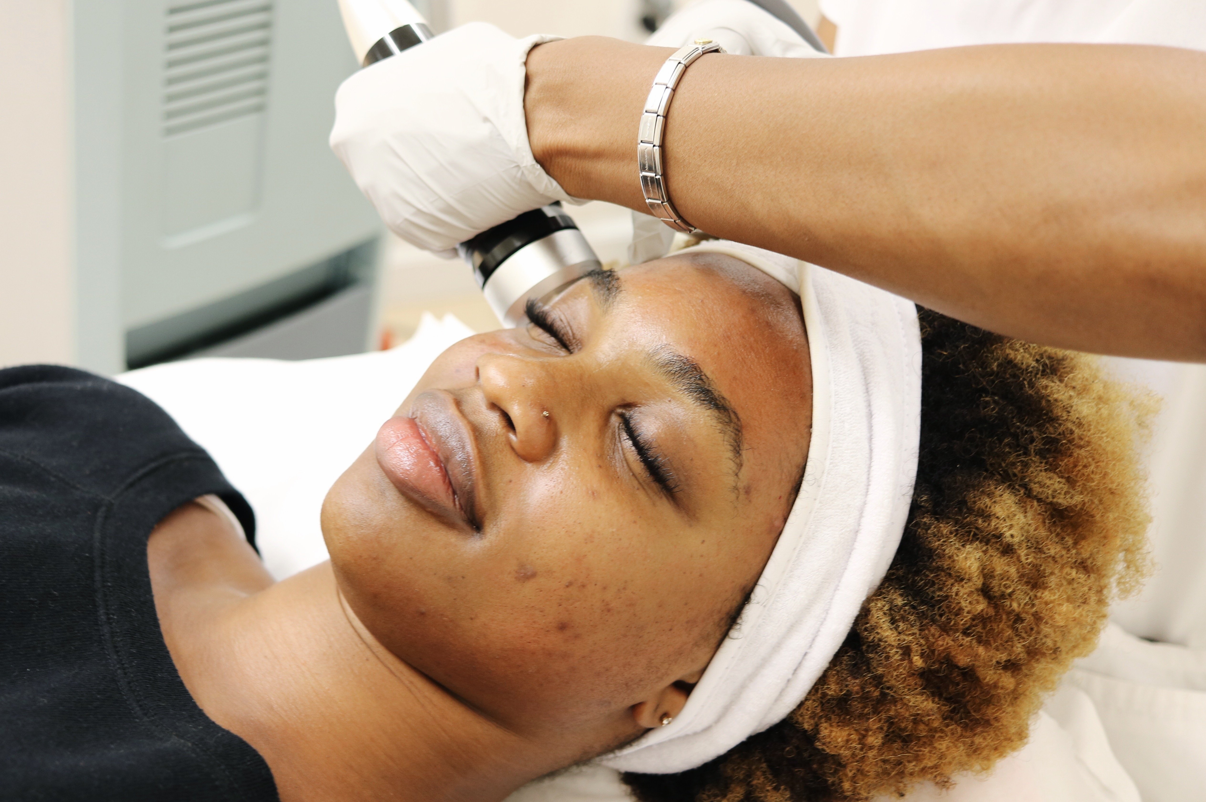 Benefits Of Microneedling For Hyperpigmentation Ijeoma Kola