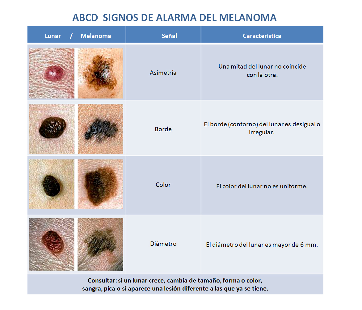 Prevención Y Diagnóstico Precoz Del Melanoma Palabra De Enfermera