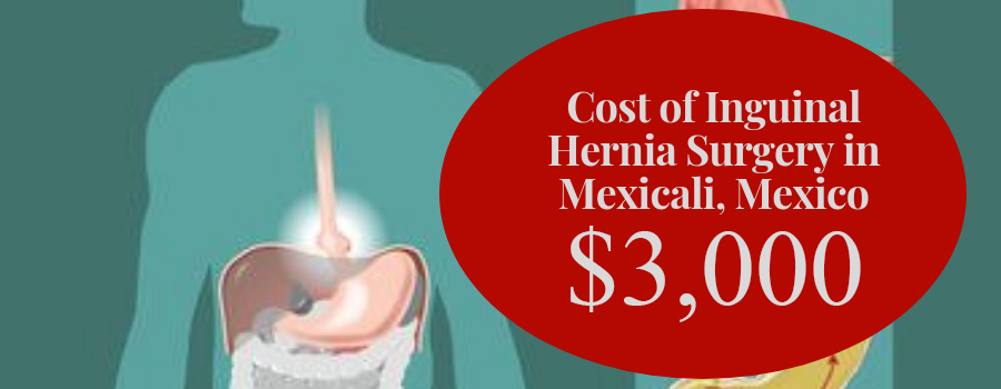 How Much Does Umbilical Hernia Surgery Cost With Insurance