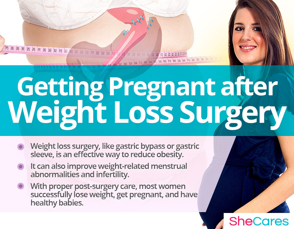 Getting Pregnant After Gastric Sleeve Pregnantsa