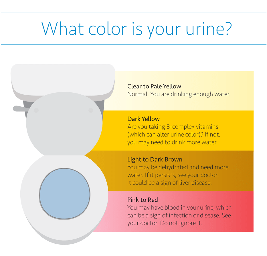 What Color Is Your Urine Supposed To Be Genadi Giorgadze