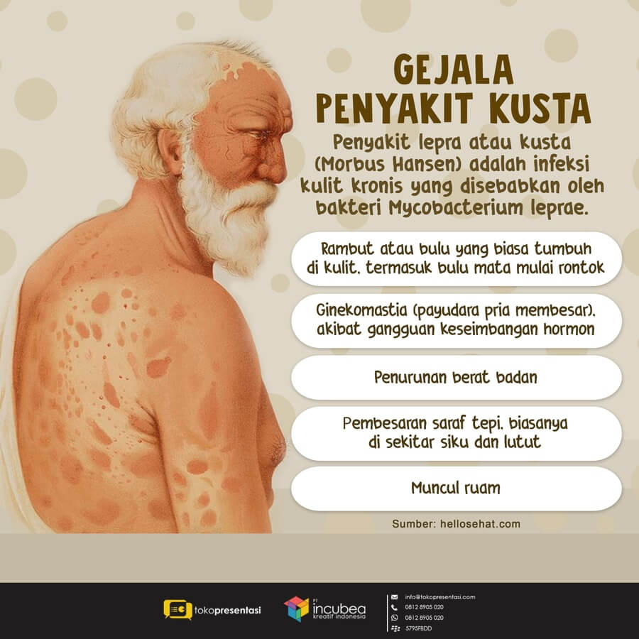 Foto Mengenal Apa Itu Penyakit Kusta Penularan Gejala Dan Sexiz Pix