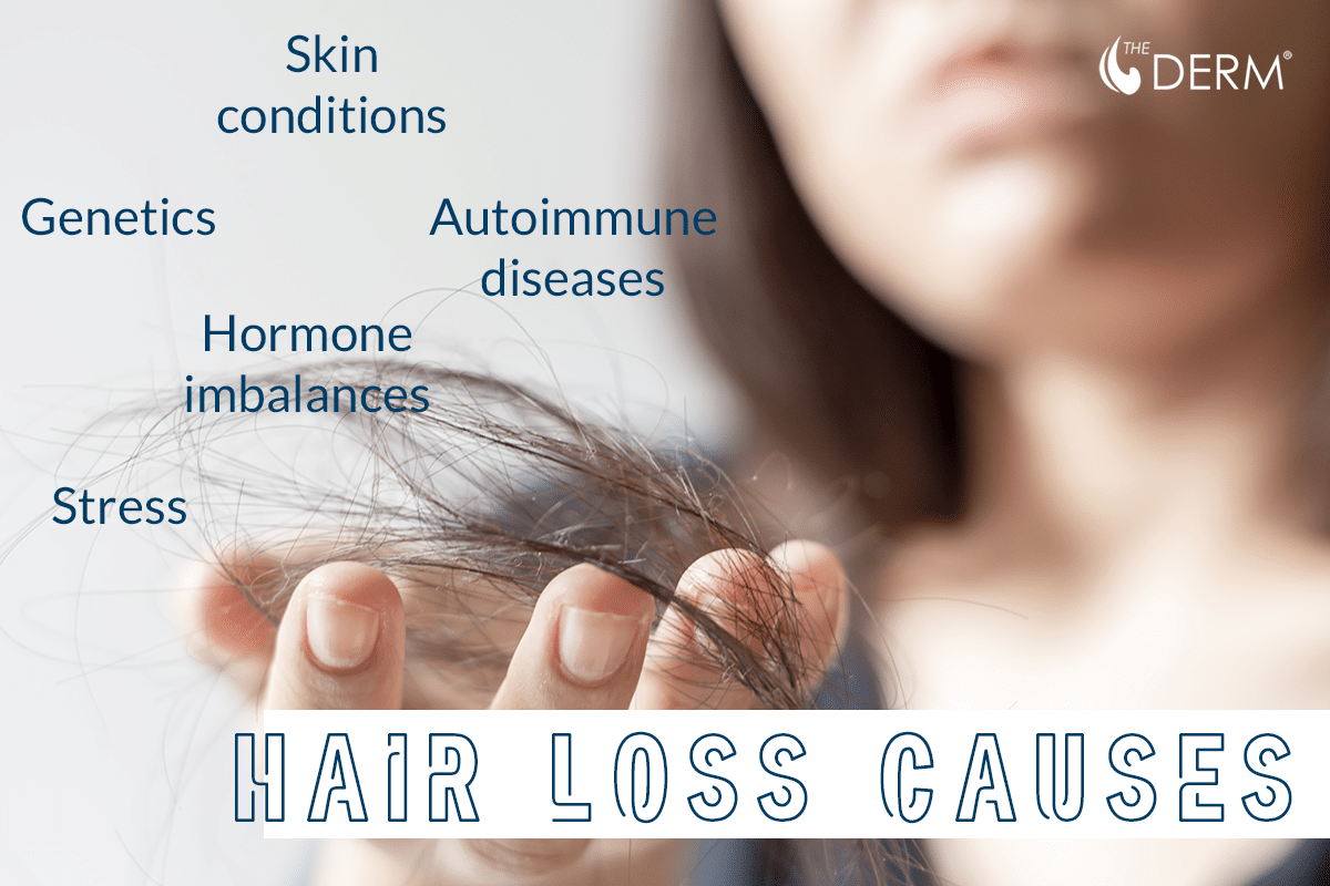 What Causes Hair Loss ~ All About Best Hair Restoration