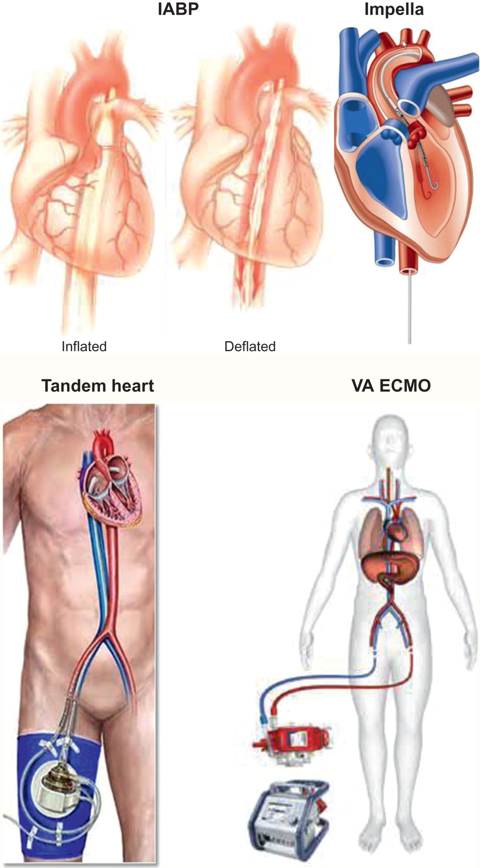 Hemodynamic Support Thoracic Key