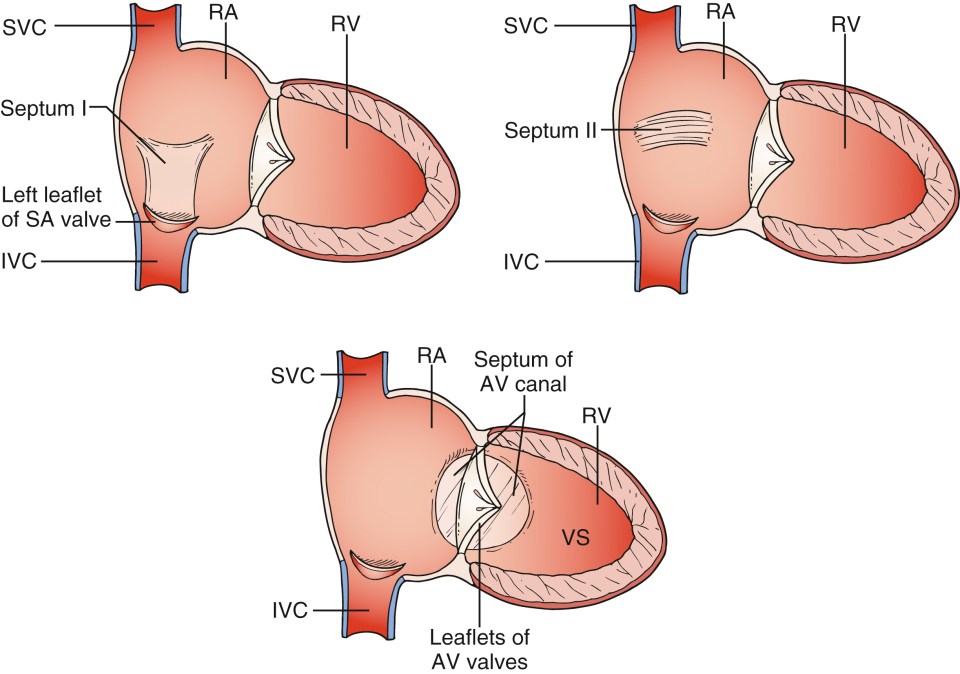 Interatrial Septum And Interventricular Septum