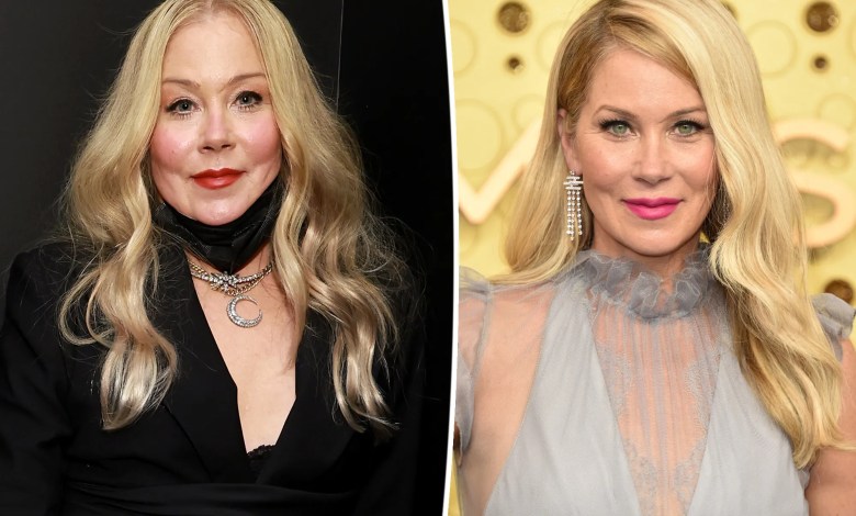 Christina Applegate Slams Troll Accusing Her Of Bad Plastic Surgery