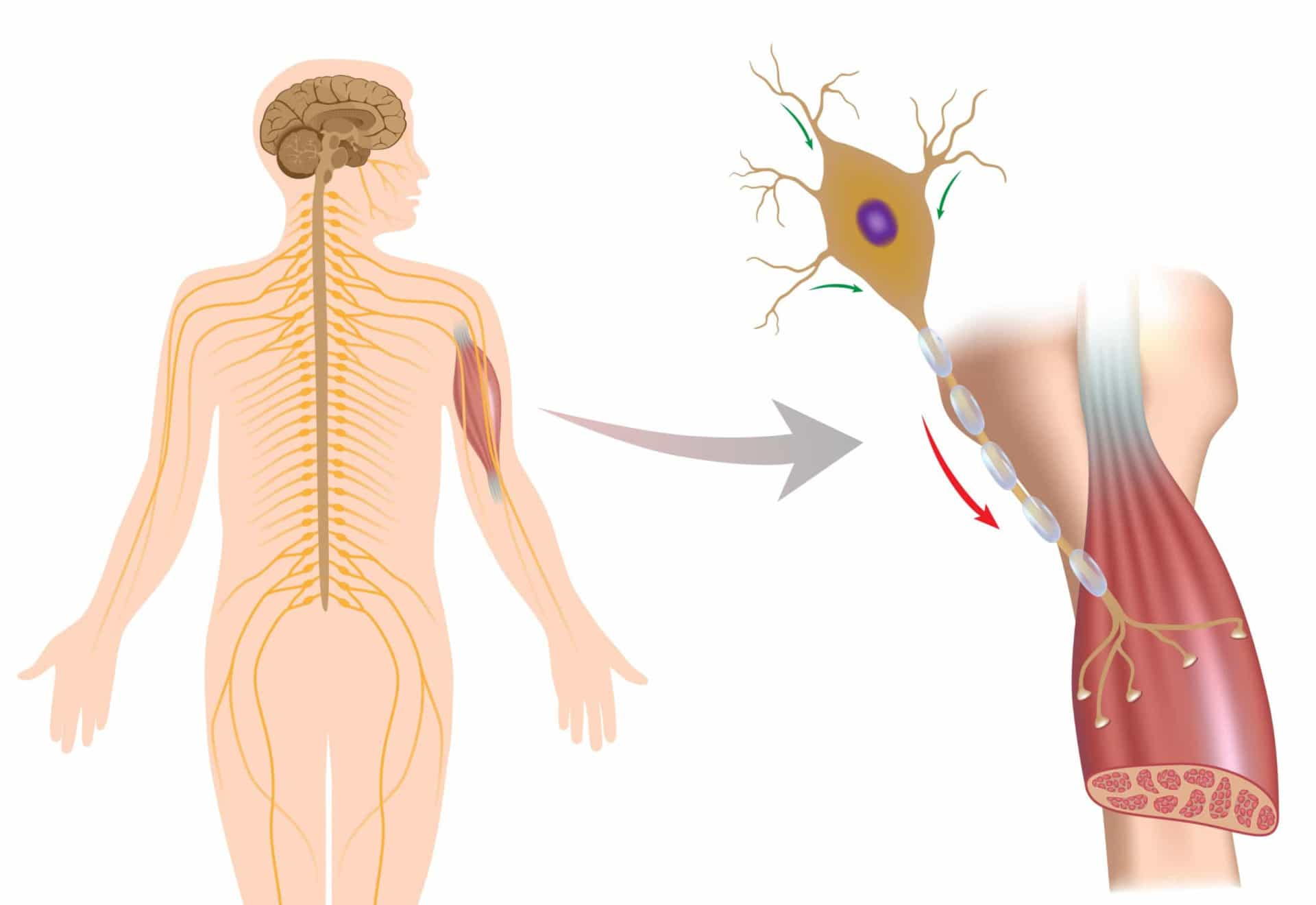 The Devastating Effects Of Spinal Muscular Atrophy