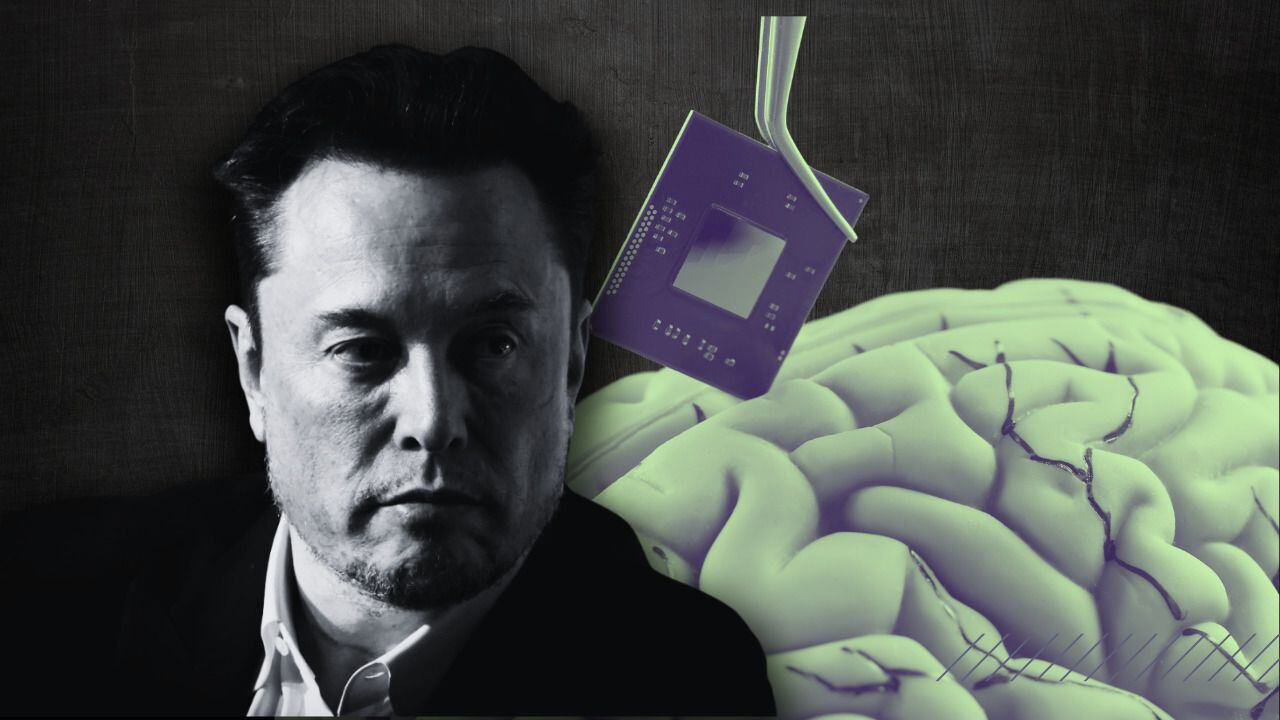 Neuralink De Elon Musk Busca A Un Segundo Candidato Para Probar Su