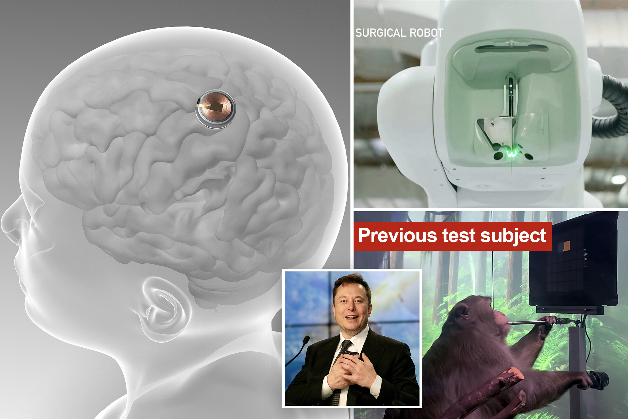 Elon Musks Startup Neuralink Implants Chip Into Brain Of First Human