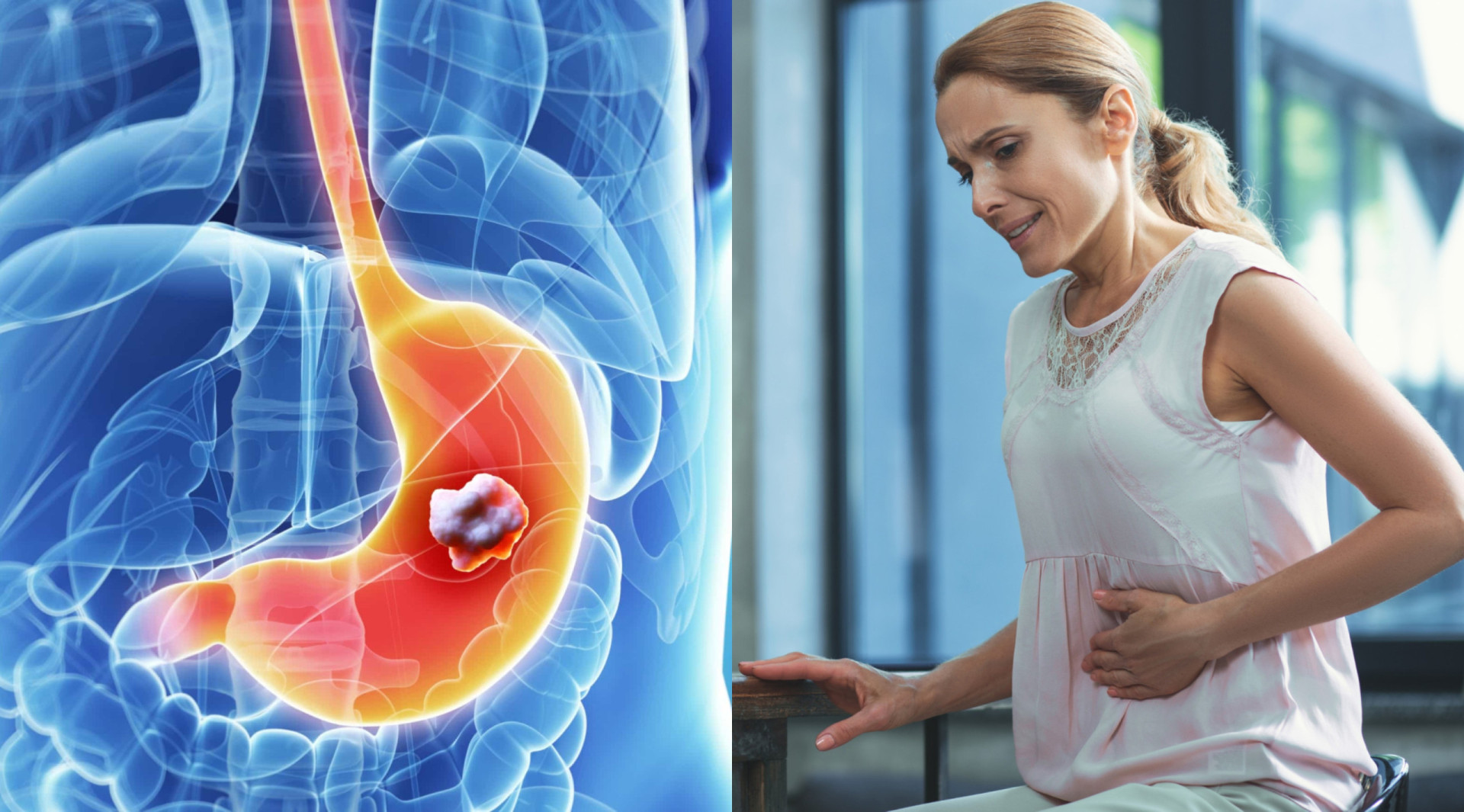 Stomach Cancer Causes Warning Signs And Treatment