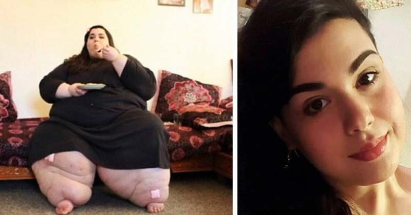 Amber Rachdis Incredible ‘my 600 Pound Life Weight Loss Transformation