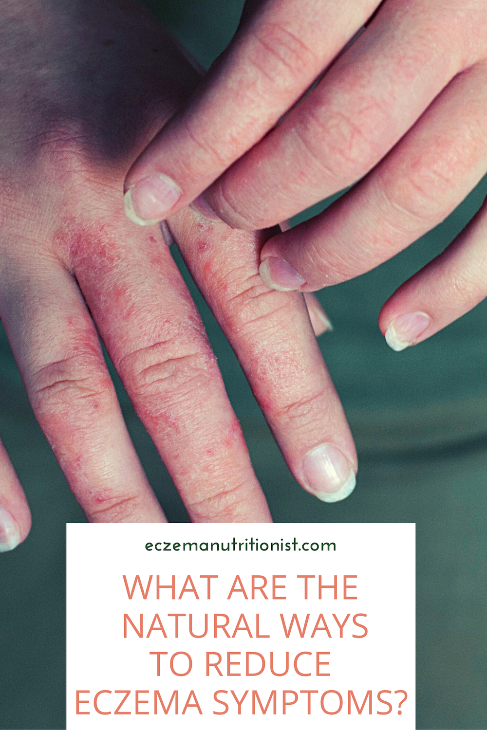 What Are The Natural Ways To Reduce Eczema Symptoms