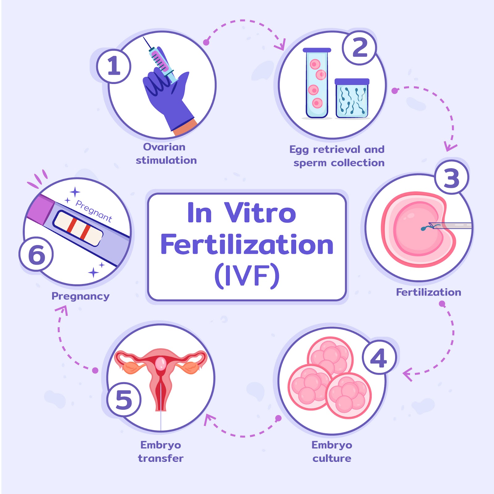 Fertilizimi In Vitro Ivf Çfarë është