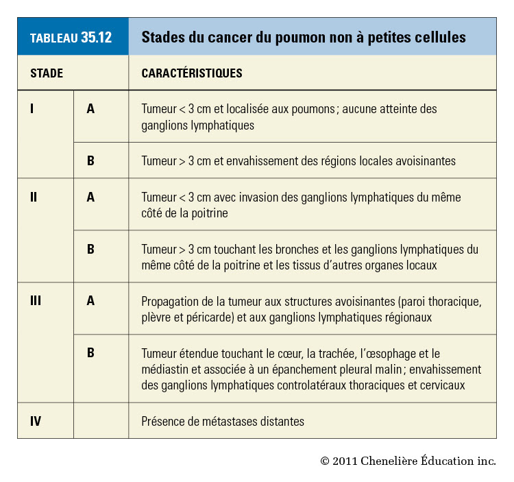 Most Cancers Des Poumons Stade Three