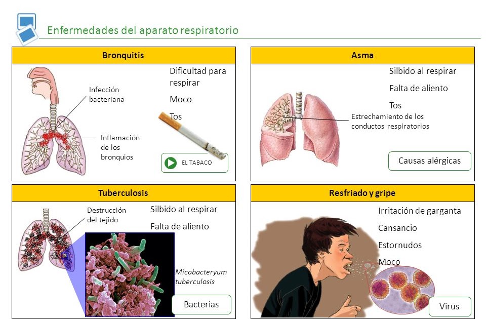 Enfermedades Del Sistema Respiratorio Infecciones My Xxx Hot Girl