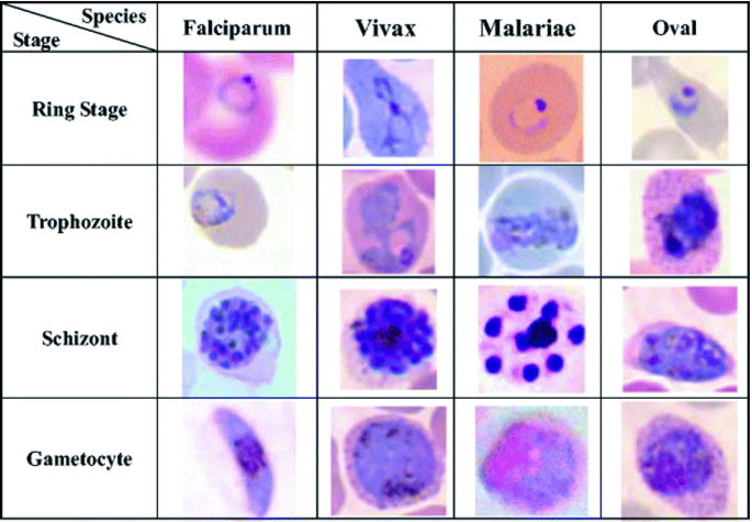 Giemsa Stain Principle Procedure Results • Microbe Online