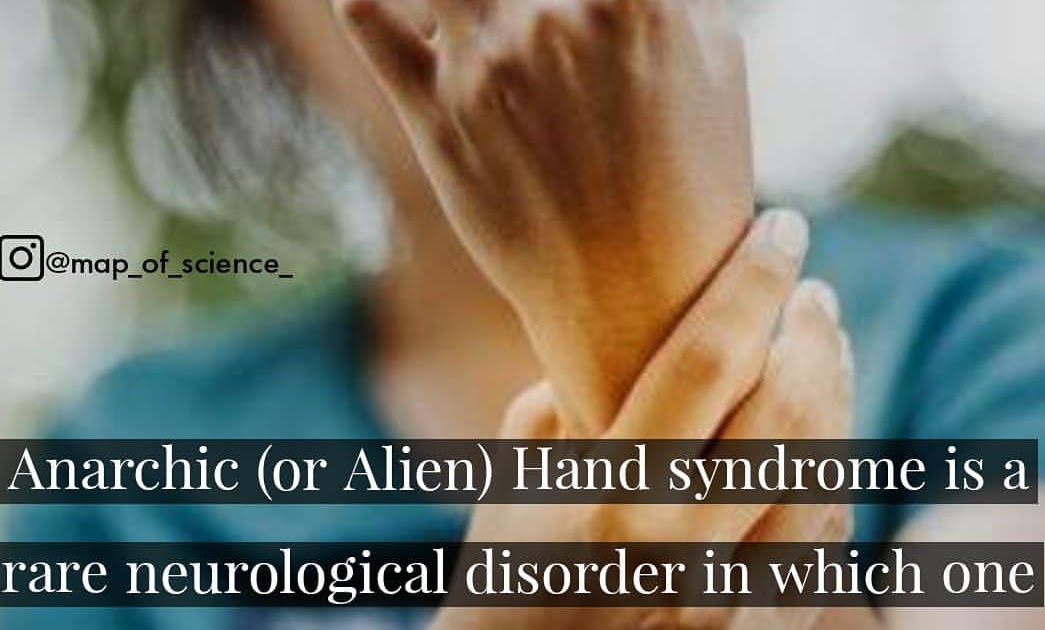 Alien Hand Syndrome Ahs Or Dr Strangelove