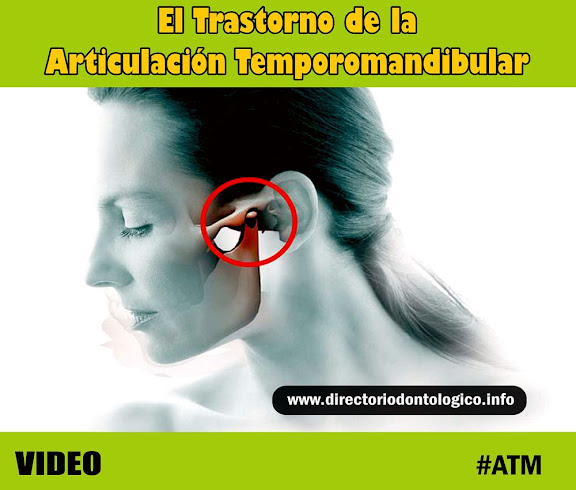 Atm El Trastorno De La Articulación Temporomandibular Directorio