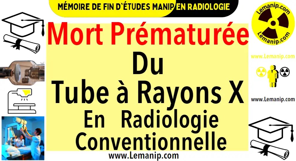 Mort Prématurée Du Tube à Rayons X En Radiologie Conventionnelle