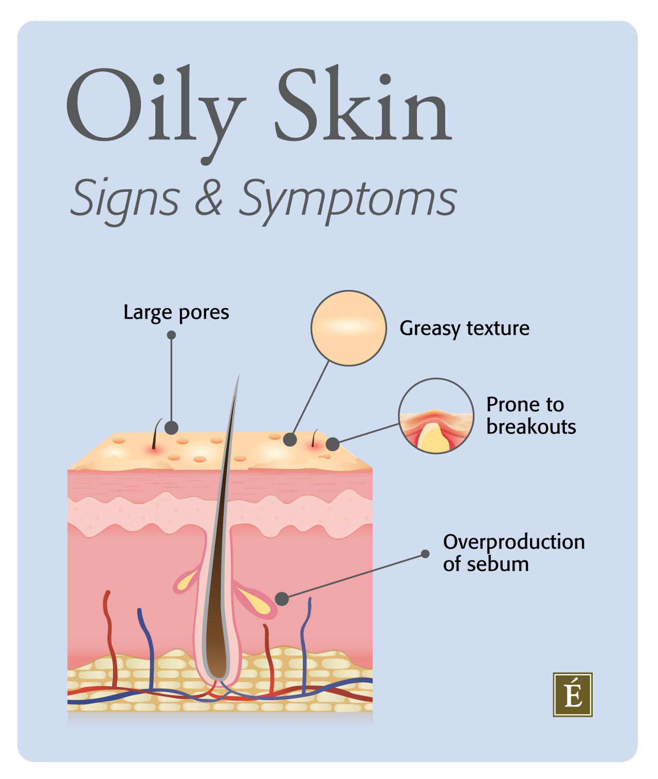 Ultimate Guide For Oily Skin Everything You Need To Know Approx