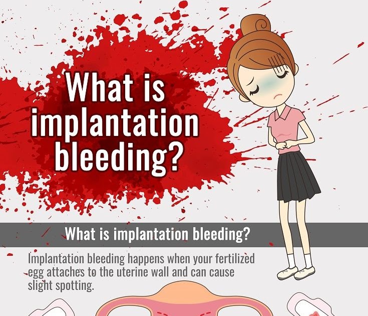 4 Types Of Bleeding In Pregnancy Peter Brown Bruidstaart