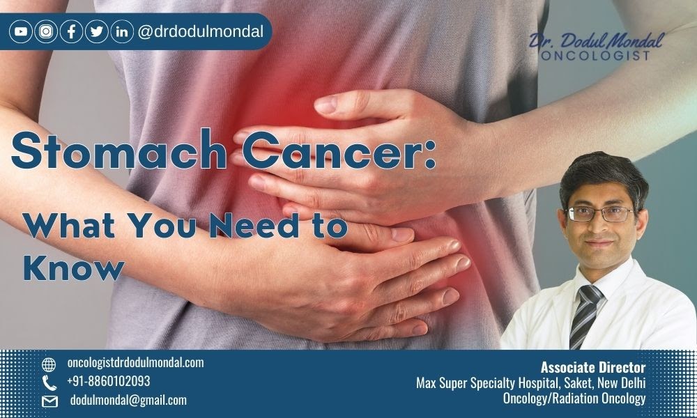 Best Radiation Oncologist In Delhi Ncr Stomach Cancer What You Need