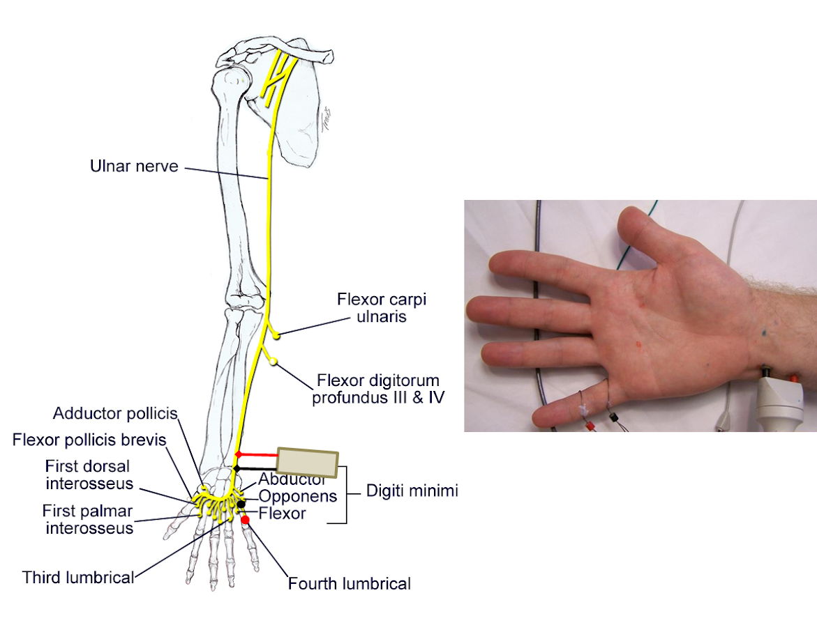 Ulnar Nerve Exam